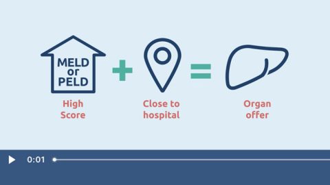 Animated videos describe MELD, PELD formulas | UNOS