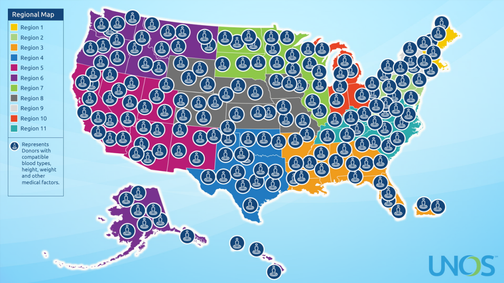 Facts about organ donation | UNOS